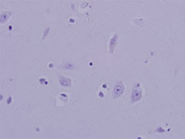 Post Mortem Brain Tissues | Advanced Tissue Services